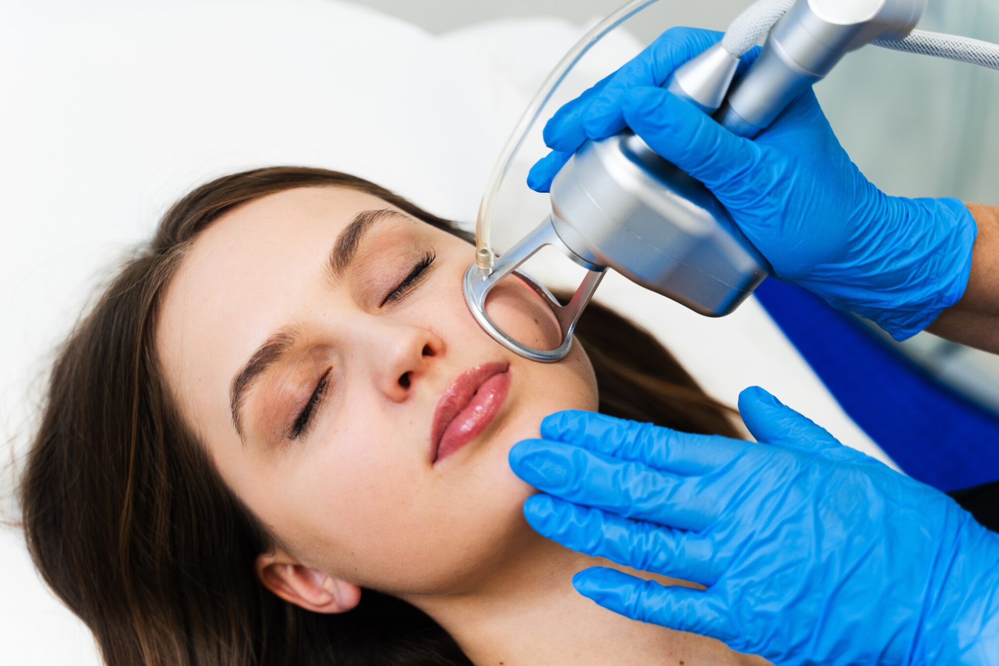DEKA CO2 Laser in Orem